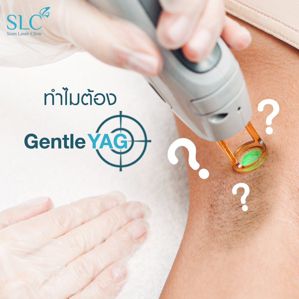 เลเซอร์ขนแบบไหนดี ผิวใส ขนหาย ผิวไม่เบิร์น Articles Slcclinics